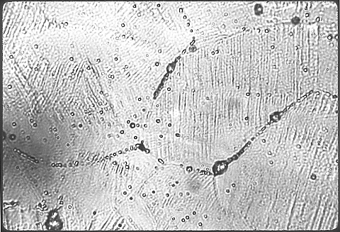 304 Stainless Steel Microstructure Enhancement Of Intergranular